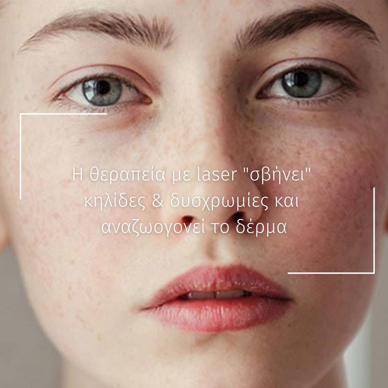 Δερματολογικό Ιατρείο: Δερμοϊατρική Αθηνών- Δερματολόγος Αθήνα